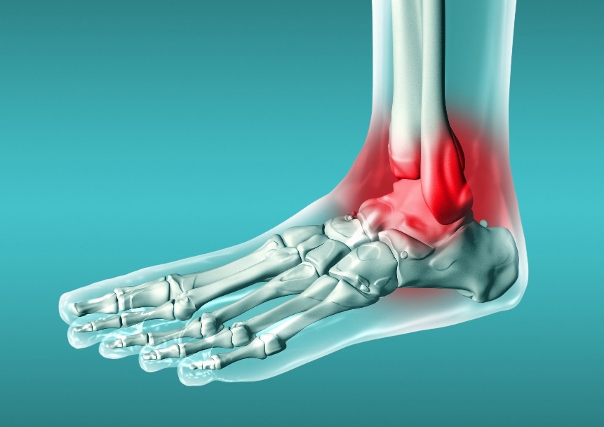 Sentara Northern Virginia Medical Center introduces Total Ankle Program